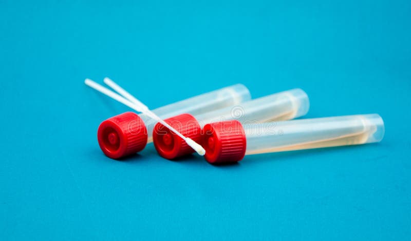 Pharyngeal swab and tube stock photo. Image of patient - 39658806