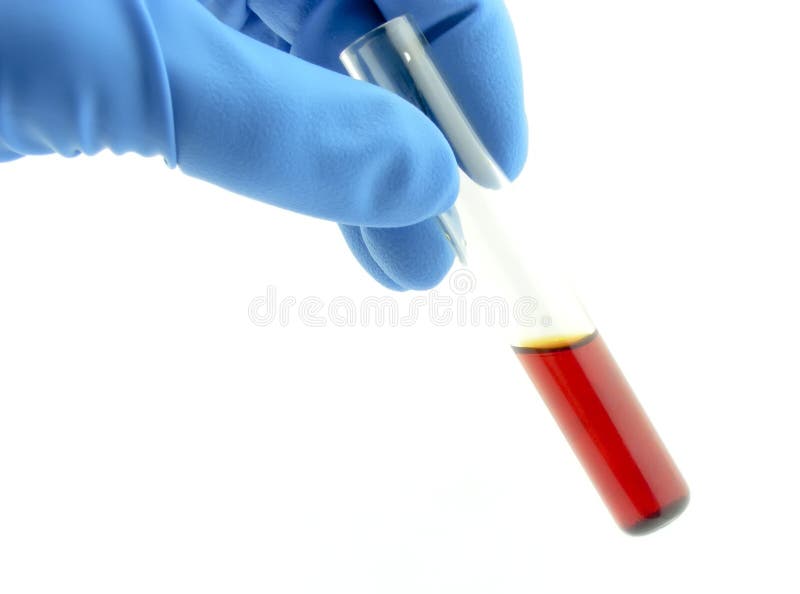 Phiole mit Chemikalie stockfoto. Bild von glaswaren, chemie - 13864312