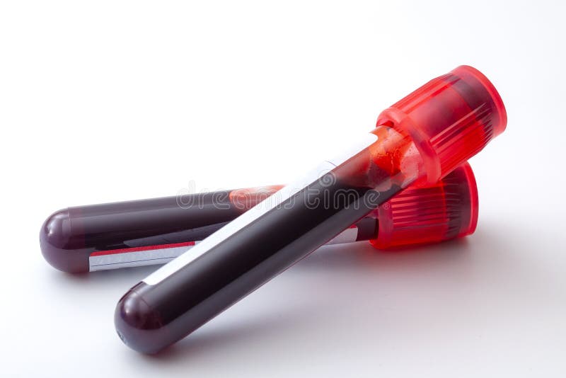 Phlebotomy, Biochemical Analysis, Laboratory Exam and Blood Testing ...