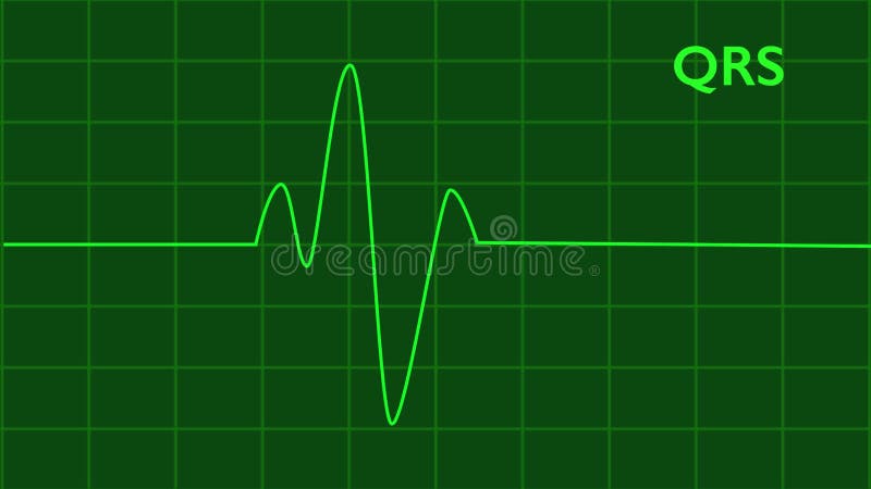 EKG Heartbeat on Monitor Recording of Pulse Green Line Rendered HD ...