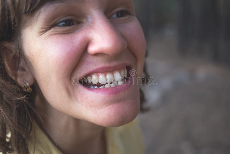 Photo of Crooked Woman Teeth Stock Photo - Image of braces, face: 153314212