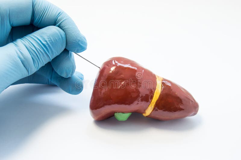 Un Homme Tient Le Foie Douleur Dans Labdomen Cirrhose Photo Stock Image Du Ventre Maladie