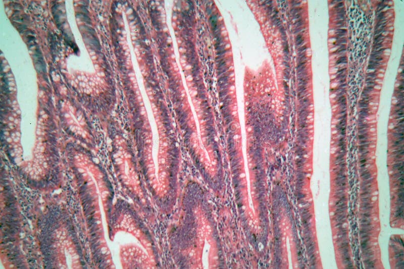 Intestine Cells Under the Microscope Stock Photo - Image of mammalian ...