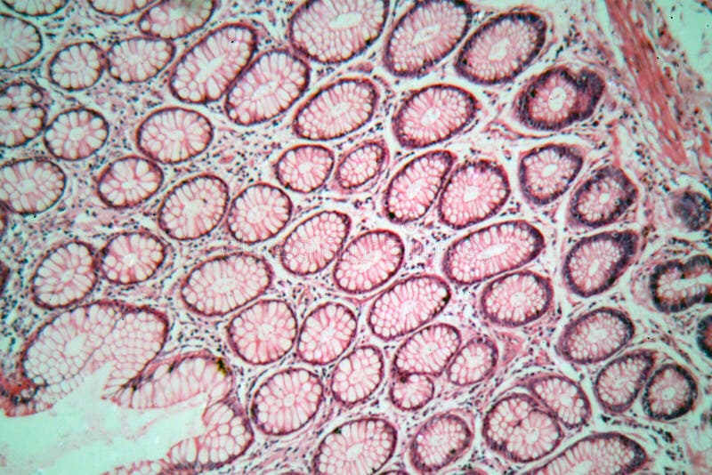 Photo of Large Intestine Cells. Stock Image - Image of human, medicine ...