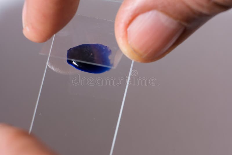 Specimen on glass slide stock image. Image of pathology - 276412013