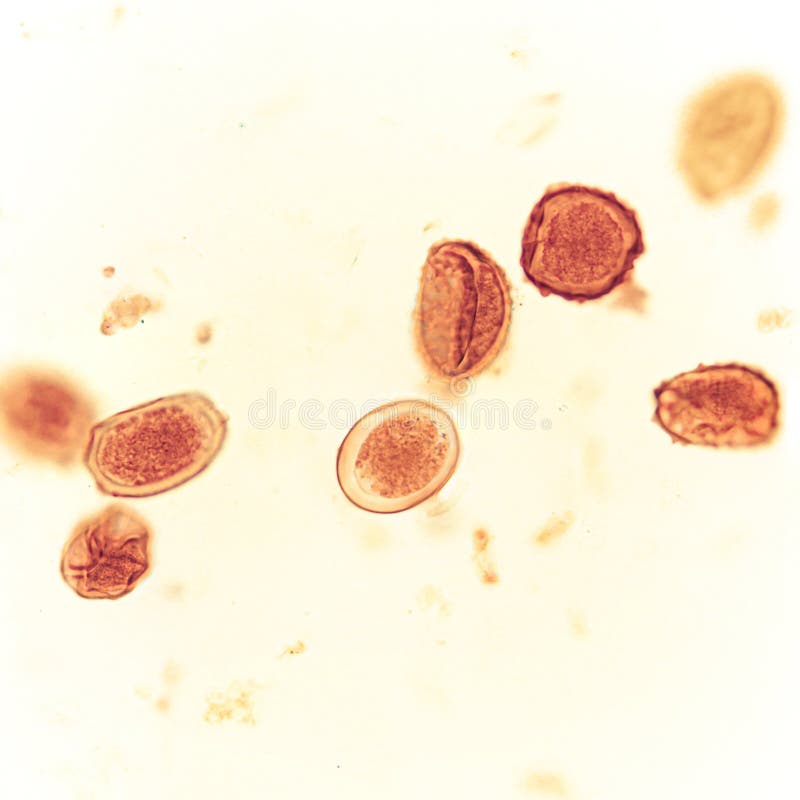 Ascaris eggs stock image. Image of symptoms, infectious - 345549439