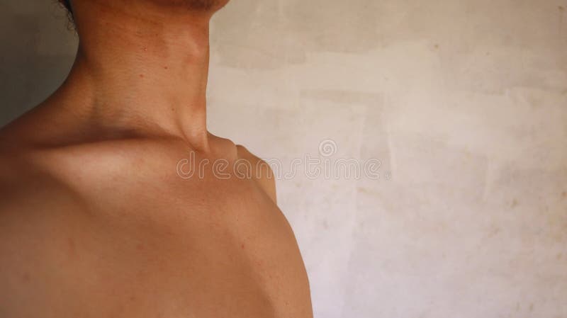 Photo of the Shoulder and Chest Area of a Thin Man Stock Image - Image ...