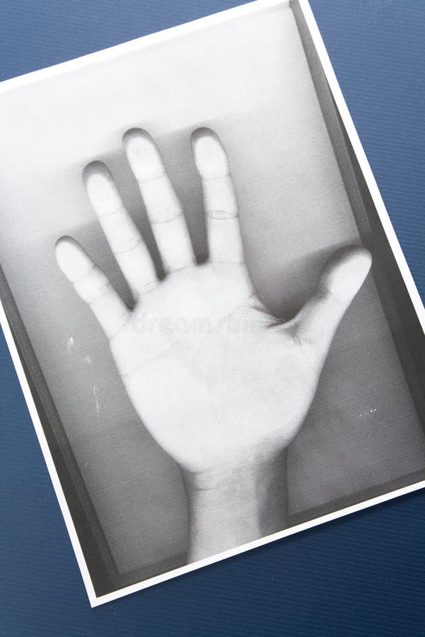 Photocopy of hand stock image. Image of depression, finger - 7004297