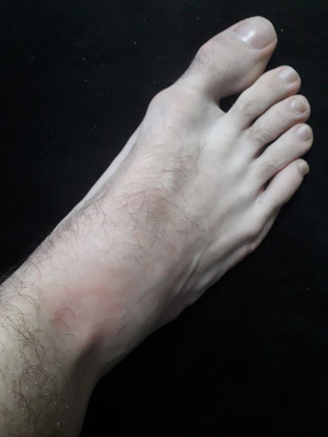 A Photograph of a Human Foot Stock Photo - Image of toes, nail: 187675434