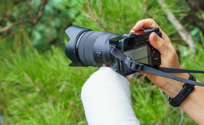 A Photographer with a Broken Arm in a White Plaster Cast Holding a Big ...
