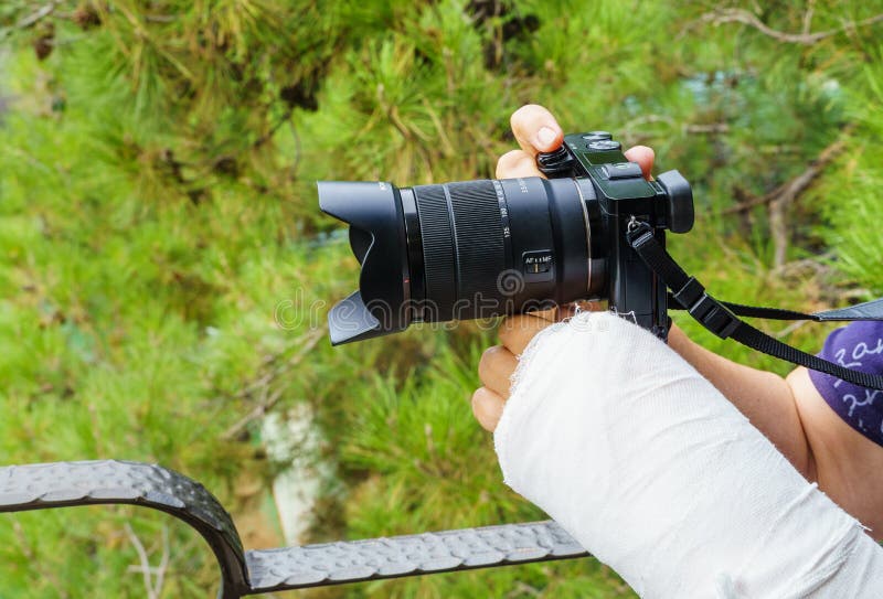 A Photographer with a Broken Arm in a White Plaster Cast Wrist Support ...
