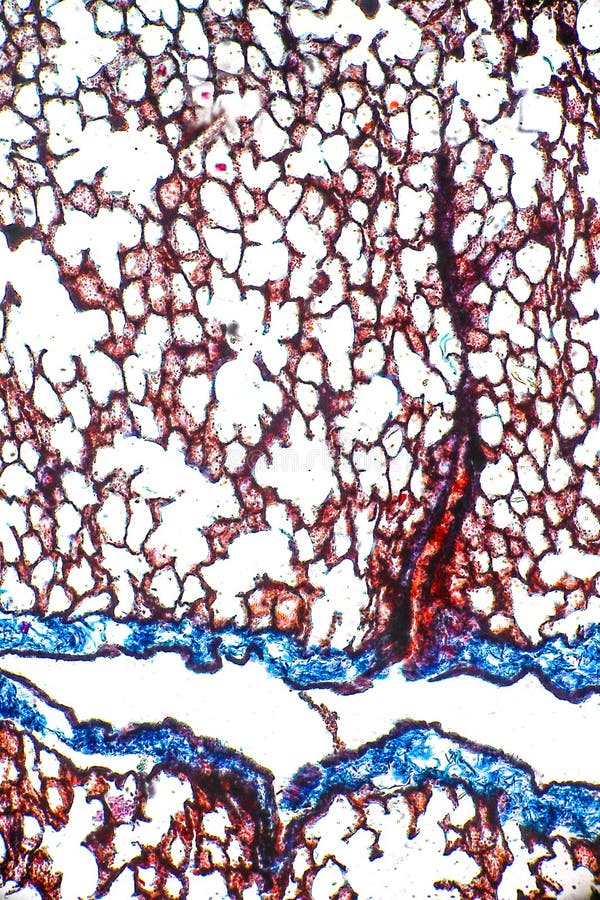 A Photomicrograph of Healthy Human Lungs Magnified 60X Stock Image ...