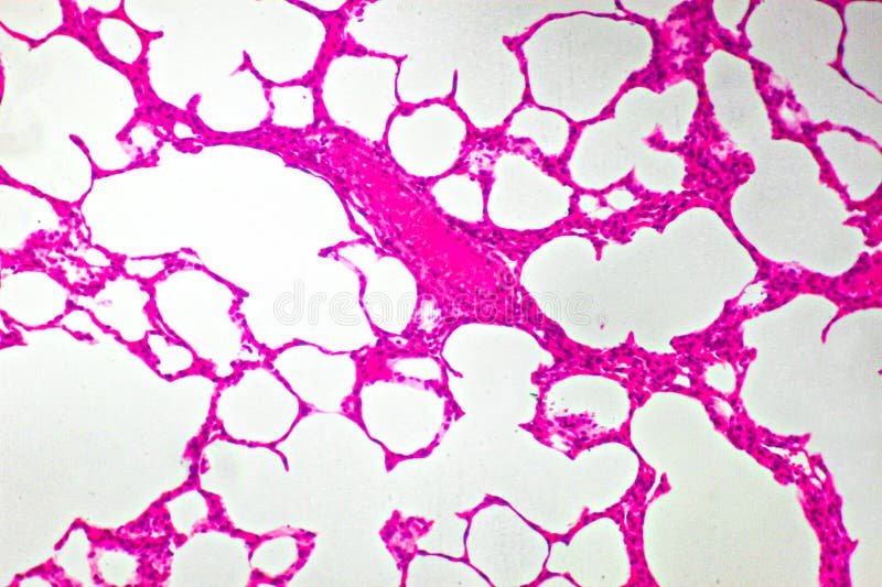 Photomicrograph, Human Lung Under the Microscope Stock Image - Image of ...