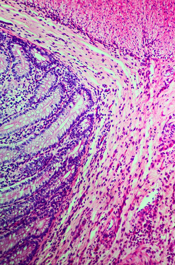 A Photomicrograph of the Large Intestine Under the Microscope Stock ...