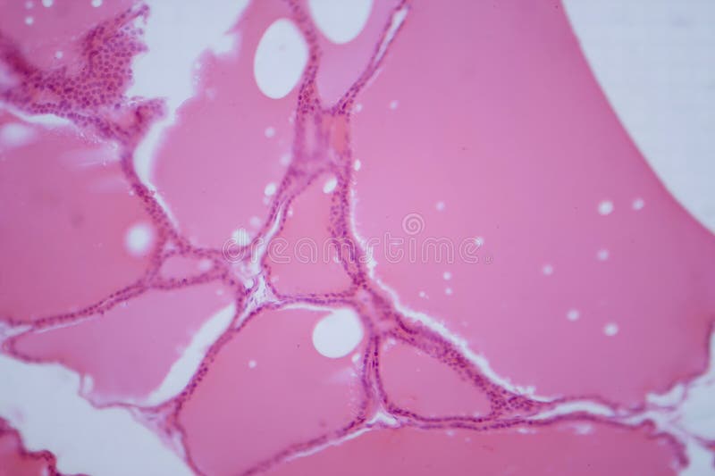 Thyroid Gland Under a Microscope, Light Micrograph Exhibiting Typical ...