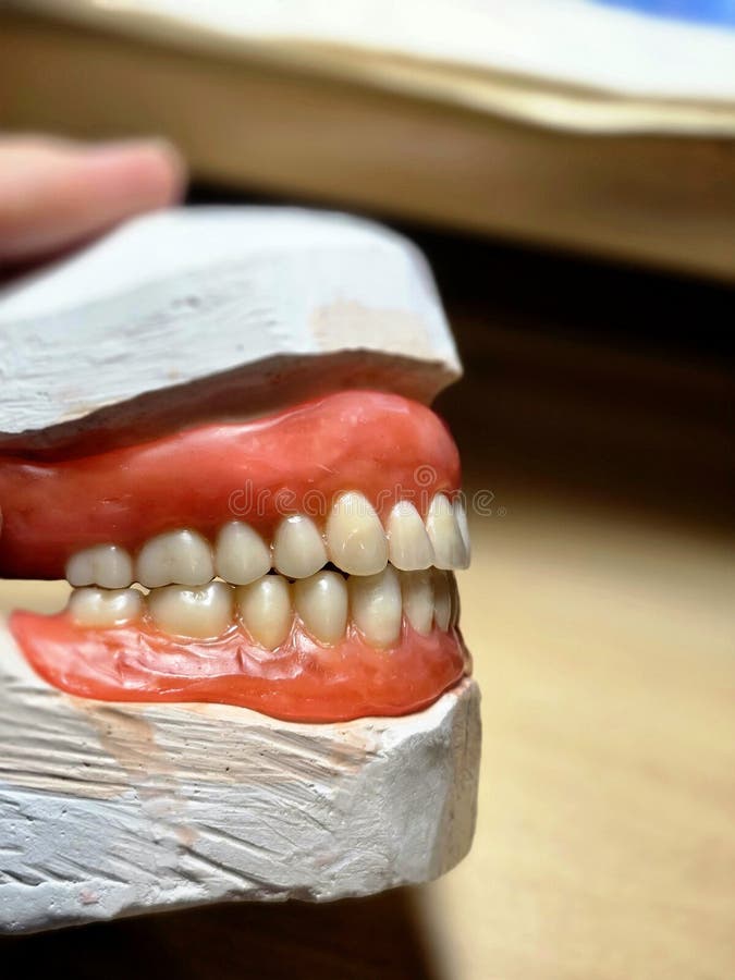 Photos of dentures in wax. stock image. Image of laboratory - 357748209