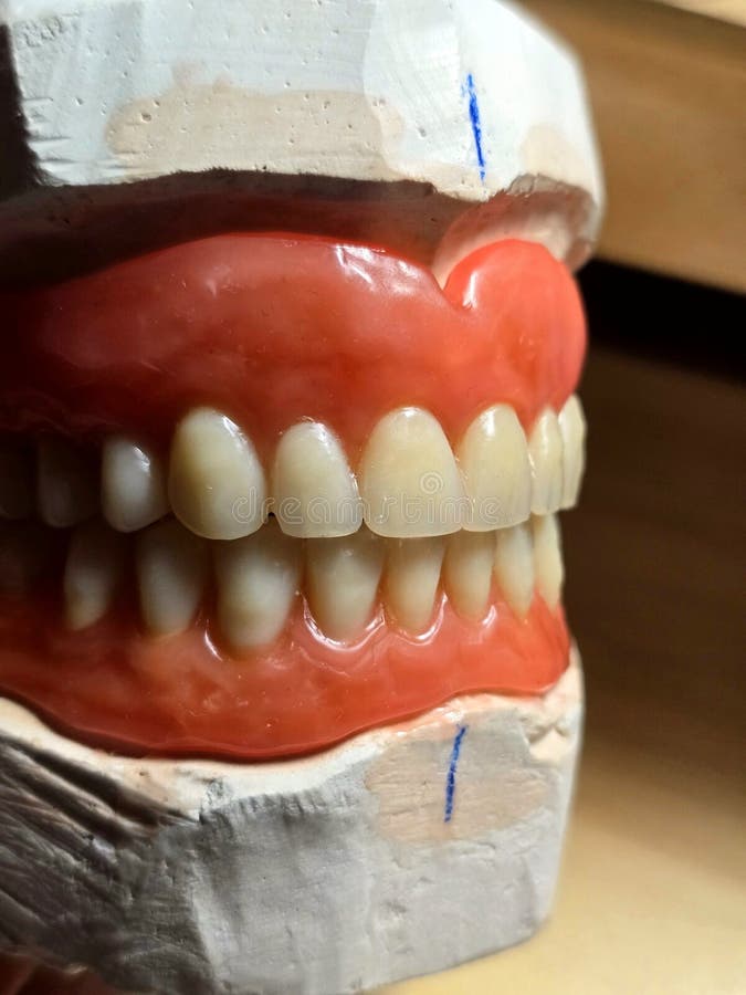 Photos of dentures in wax. stock photo. Image of face - 357748242