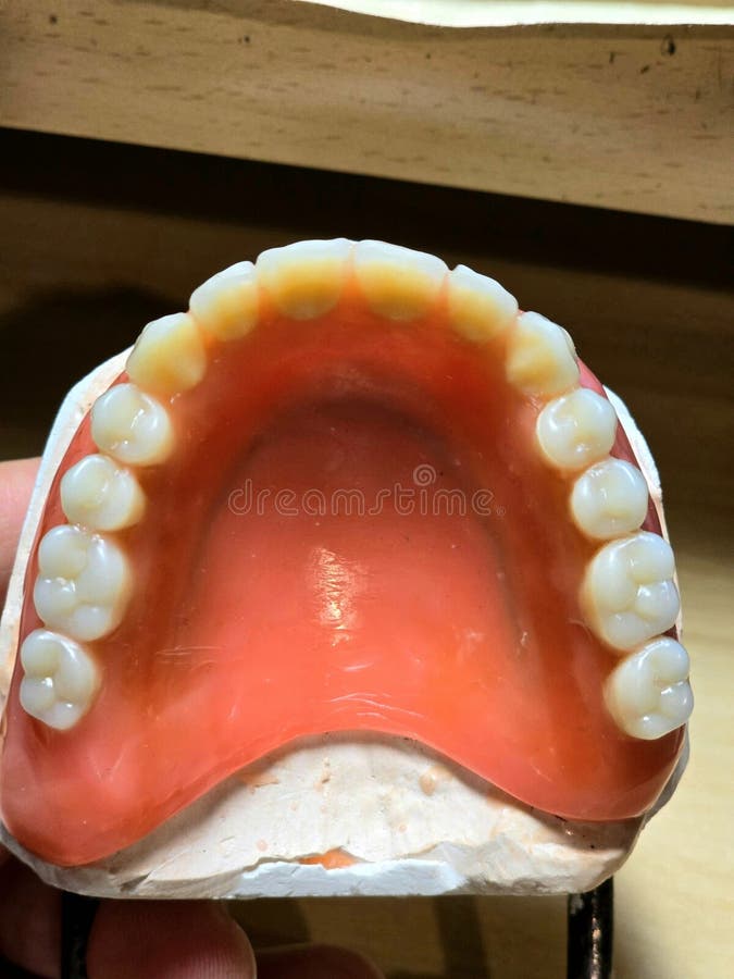 Photos of dentures in wax. stock photo. Image of denture - 357748154