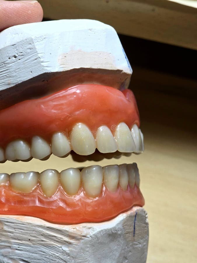 Photos of dentures in wax. stock image. Image of drawing - 357748191