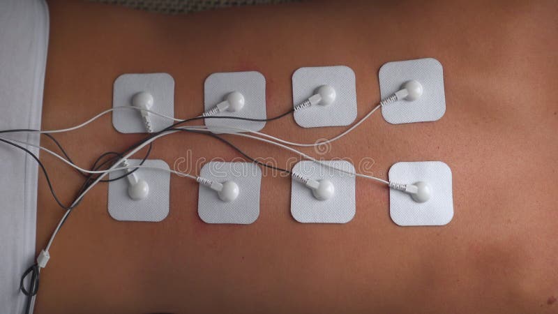 Physiotherapy of the Back with TENS Myostimulator, Electrical Nerve ...