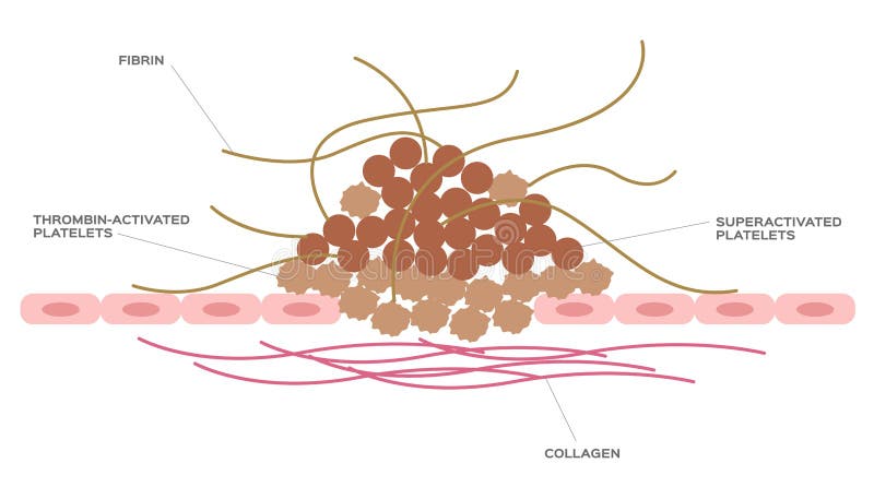 Piastrina E Fibrina Sulla Ferita Illustrazione Vettoriale ...