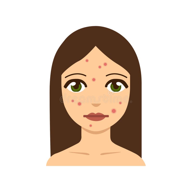 Face problems set. stock vector. Illustration of human - 103258358