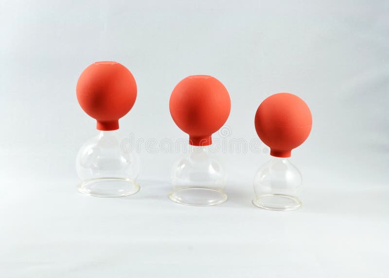 Cupping glass stock image. Image of stockphoto, healer - 30275363