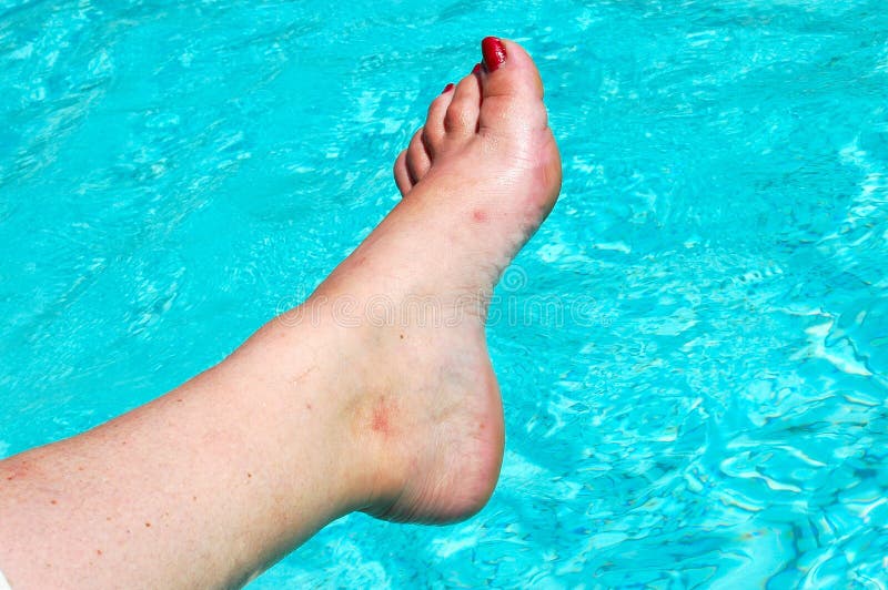 Pie dolorido foto de archivo. Imagen de hembra, muchacha - 1558948