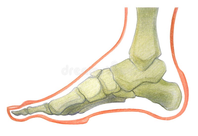 Pie, Esquema De Pie Con Callosidad De Maíz Y Plantar Stock de ...