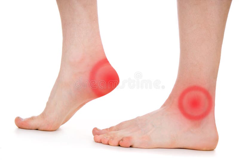 Pie masculino, talón, pies foto de archivo. Imagen de piel - 27301530