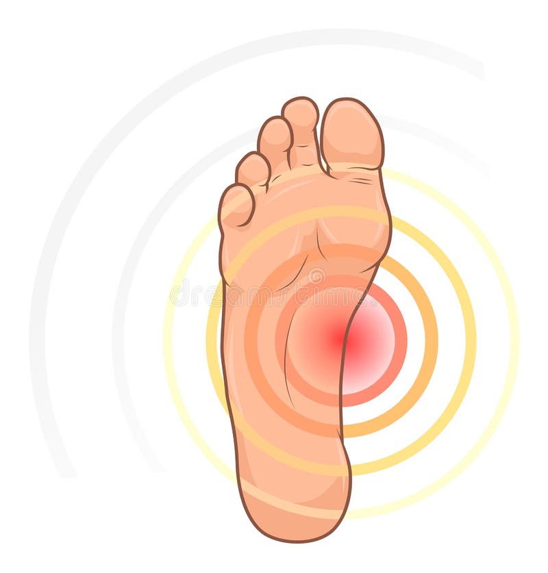 Douleur Au Pied Et Glyphe Icône Douloureux Et Mal Aux Pieds Aux Jambes ...