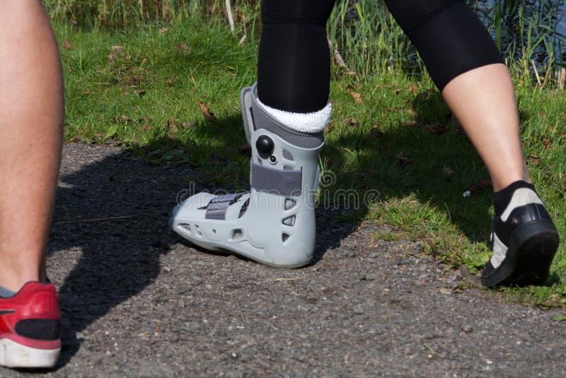 Pied cassé ! ! photo stock. Image du santé, bandage, cassé - 17677010