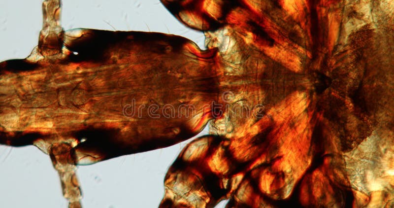 Pig louse with antennae stock video. Video of digestion - 204918859