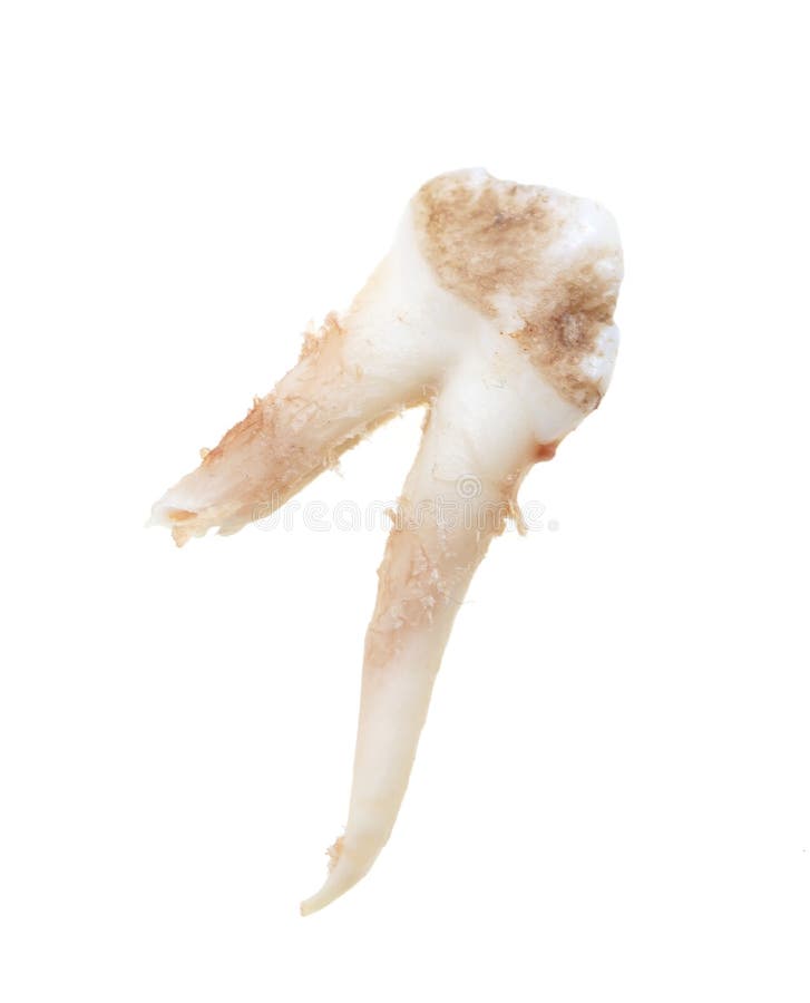 Pig Teeth Isolated on a White Background. Stock Image - Image of femur ...