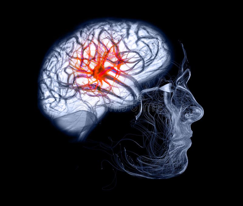 Pijn in Het Hoofd Hersenen En Synapsen Cognitieve Problemen Mentaal ... Pijn in Het Hoofd Hersenen En Synapsen Cognitieve Problemen Mentaal ...