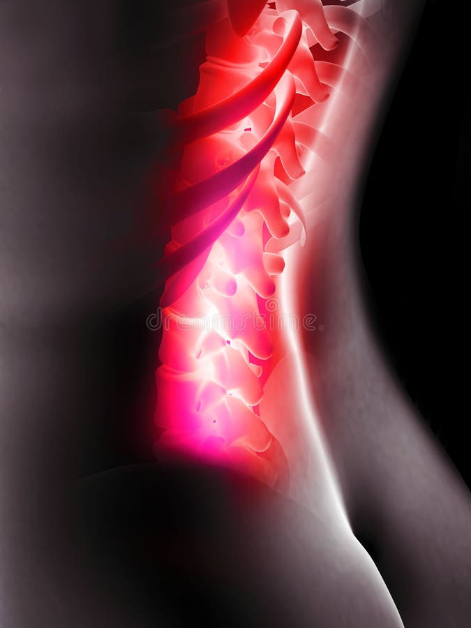 Pijnlijke rug stock illustratie. Illustration of pijn - 27524357