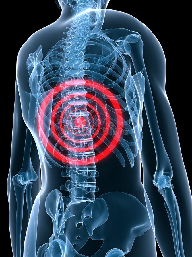 Illustratie Van De Mens En Ruggegraat Stock Illustratie - Illustration ...