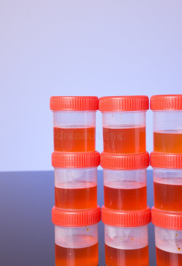 Pile of urine sample tube stock image. Image of healthcare - 89433917