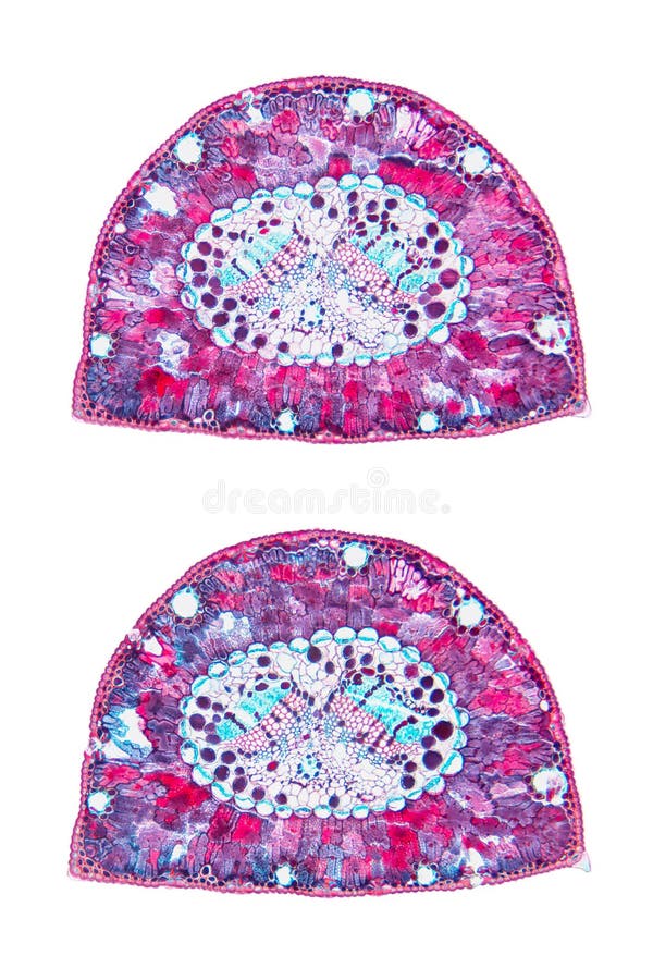 Pine Tree Leaf, Needle of Pinus, Cross Section, 20X Light Micrograph ...