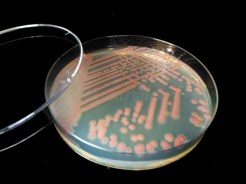 Bacteria colony stock photo. Image of microorganisms - 102778110