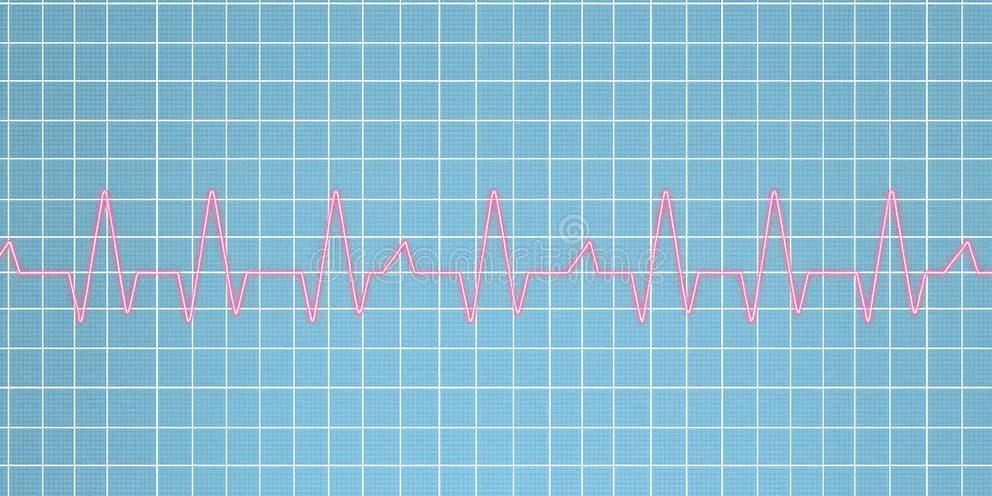 Pink EKG Line on a Blue Grid Stock Illustration - Illustration of signs ...