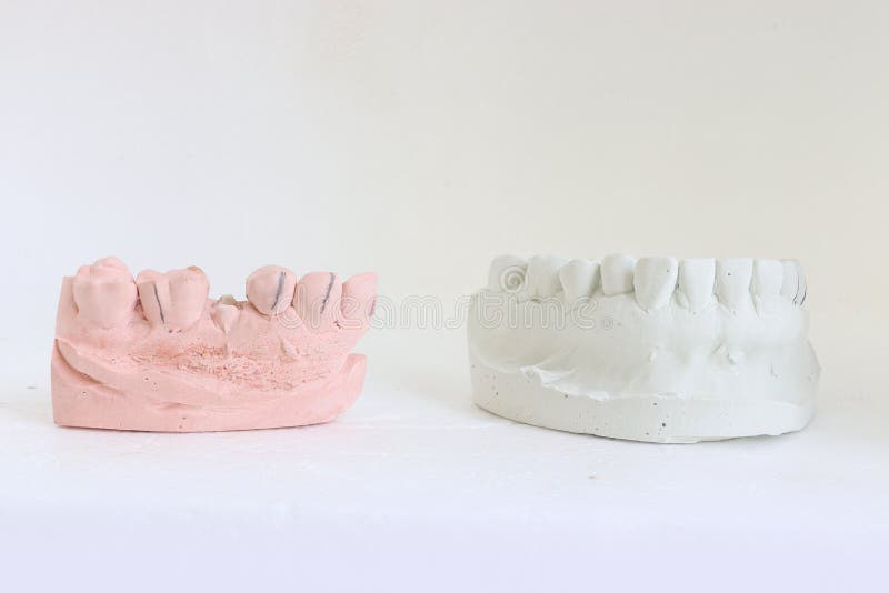 Pink and White Plaster Impression of Lower Teeth Isolated on White ...