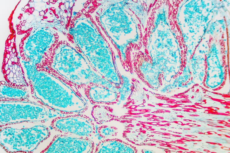 Cell Pinus Female Strobile LS Stock Photo - Image of organic, life ...