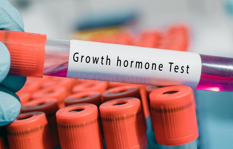 Pituitary Gland Growth Hormone GH Test Affects Growth and Development ...