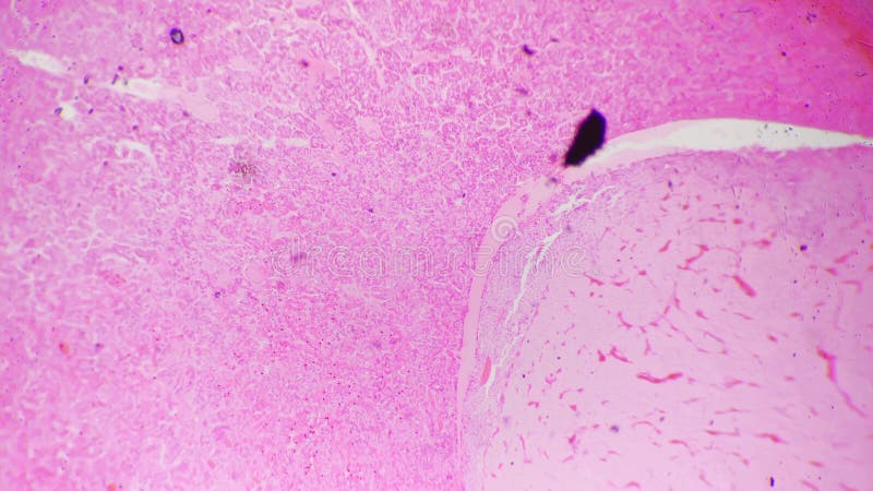 Human Pituitary Gland in Cross Section Filmed Under Microscope with ...