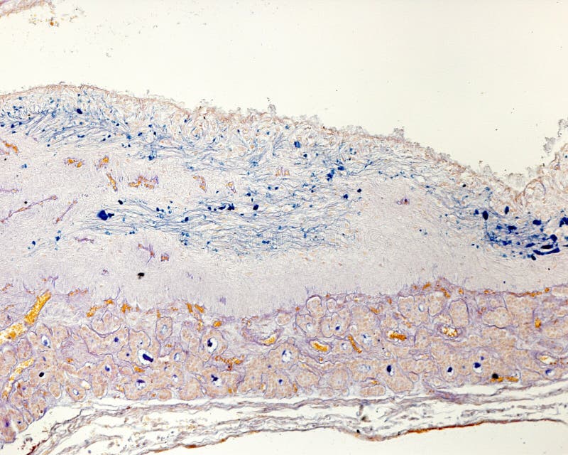 Pituitary Stalk. Neurosecretion Stock Image - Image of hypophysis ...
