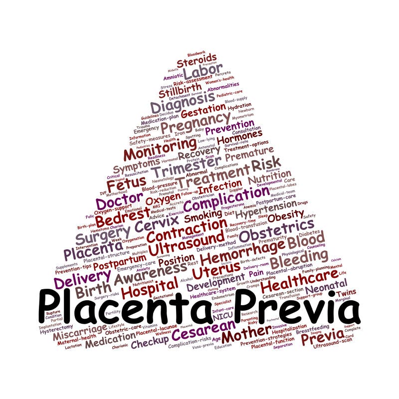 Placenta Previa Word Cloud stock illustration. Illustration of ...