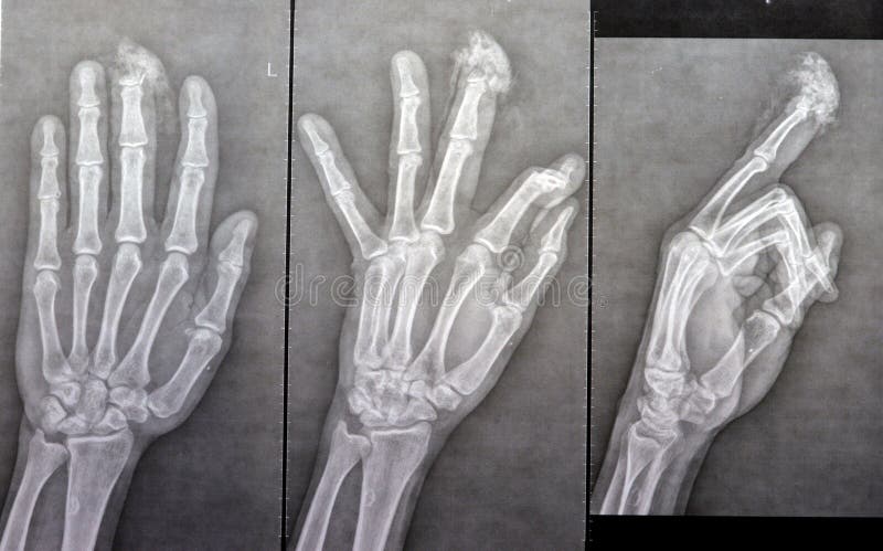 Middle Finger Skeleton Hand Stock Photos - Free & Royalty-Free Stock ...