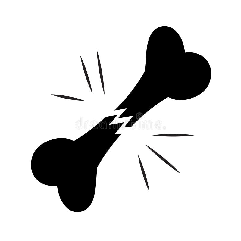 Plan De La Main Fracture Osseuse Plan Vectoriel Eps Illustration de ...