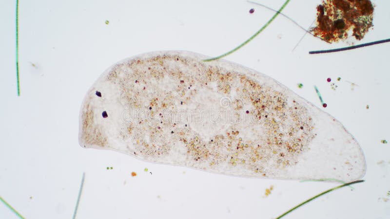 Planaria Flatworm Under the Microscope View. Stock Video - Video of ...